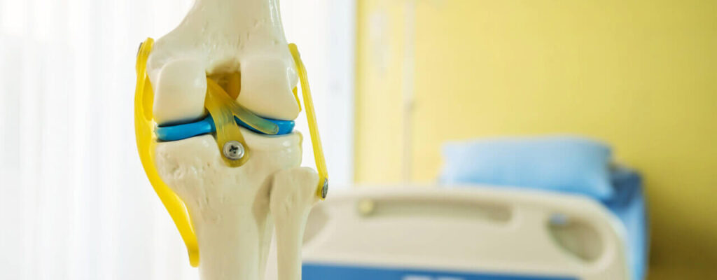 Maximizing Recovery After Joint Replacement Surgery - Rising Sun ...